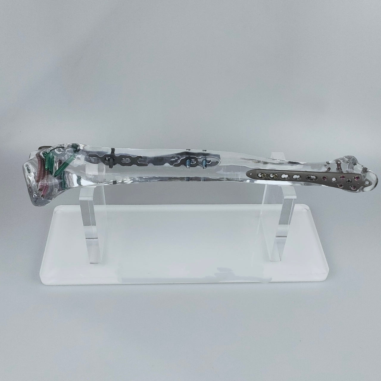 Clear bones-Trauma tibia - Orthopedic Models | Medical Training ...